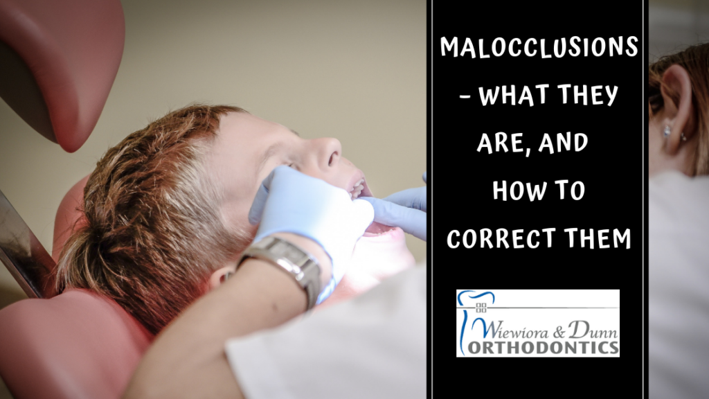 Learn About Malocclusions | Wiewiora & Dunn Orthodontics